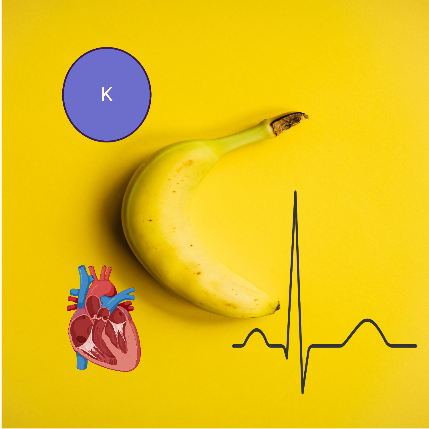 Approach to Hyperkalemia: Diagnosis and Treatment - VETEMCRIT