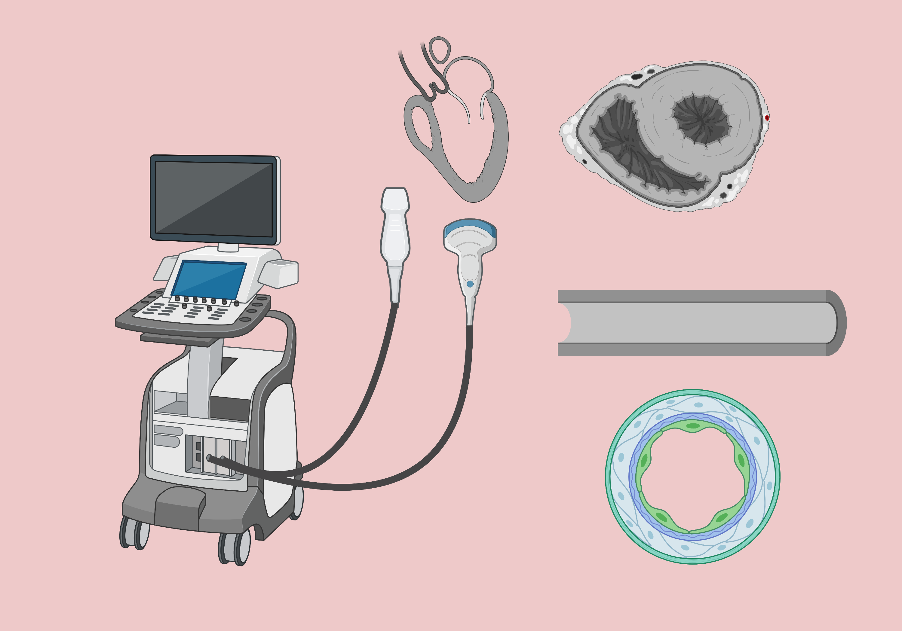 Intravascular Volume with Point-of-Care Ultrasound